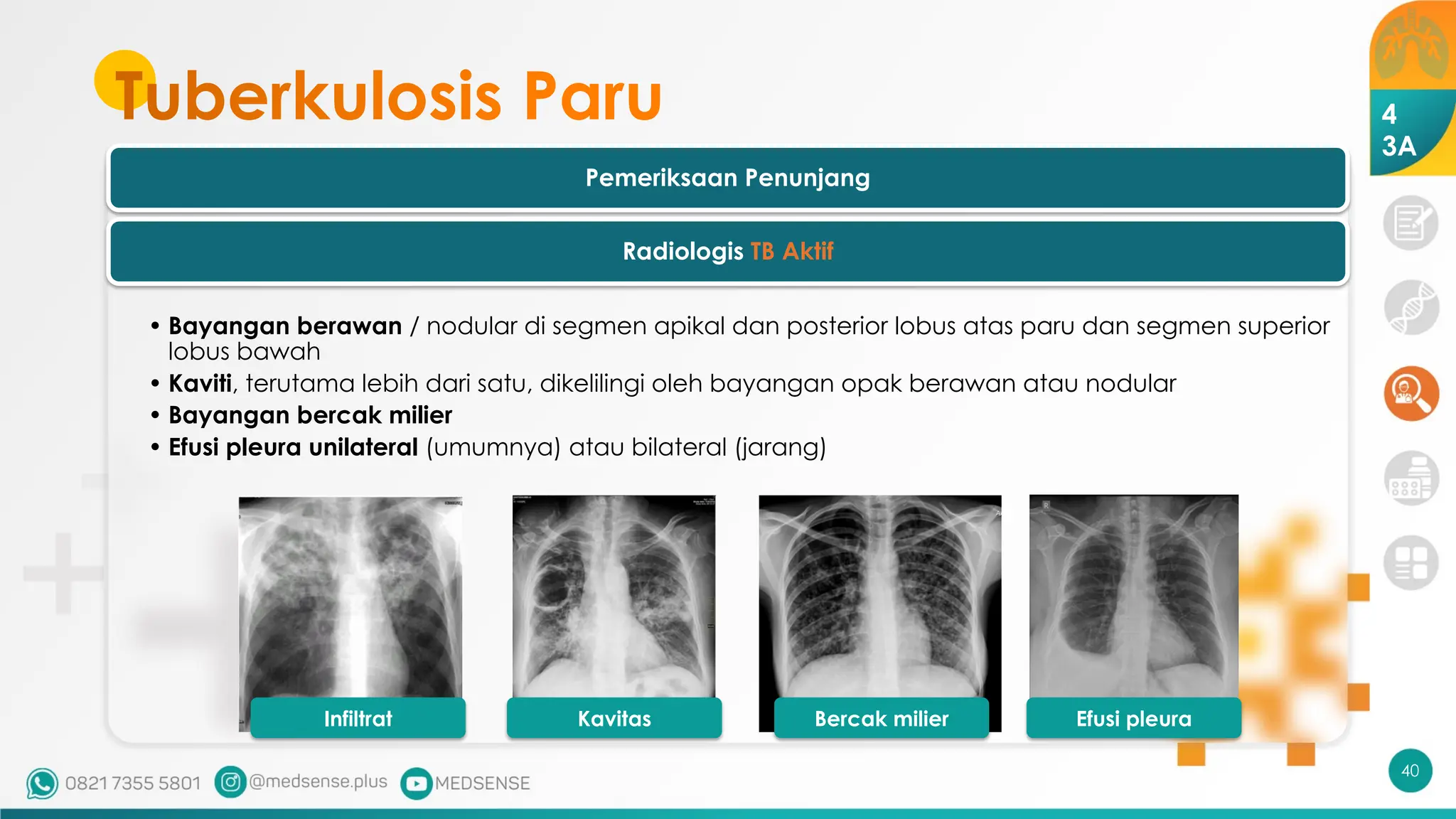 [Materi] Pulmonologi ukmppd complete class | PDF