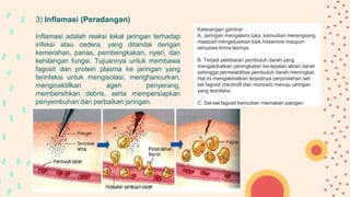 MATERI SISTEM IMUN PADA MANUSIA BY CHINTYA | PPTX