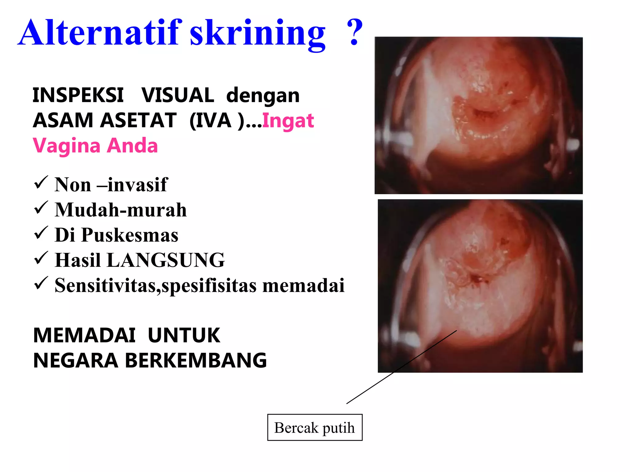 MATERI_SOSIALISASI_IVA_SADANIS.ppt