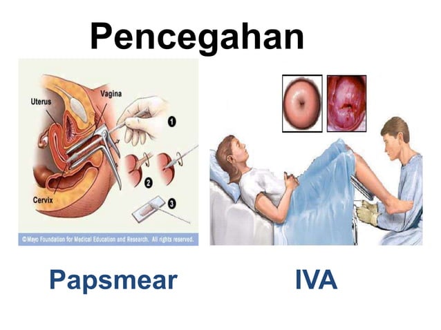 MATERI_SOSIALISASI_IVA_SADANIS.ppt