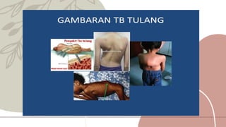MATERI SOSIALISASI / PENYULUHAN TUBERCULOSIS | PPTX