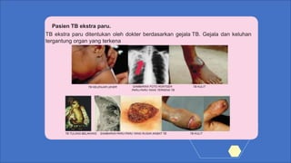 Materi Tentang Pelatihan penyakit TBC.pptx