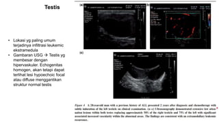 Imaging in leukemia | PPTX