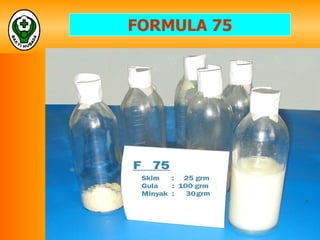 Materi v pembuatan formula pada gizi buruk | PPT