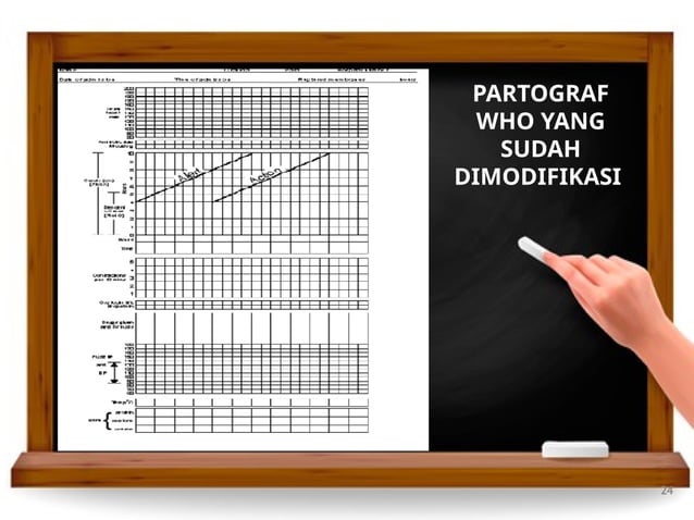 Materi Webinar Deteksi Komplikasi Kebidanan Intrapartum dengan PARTOGRAF.pptx