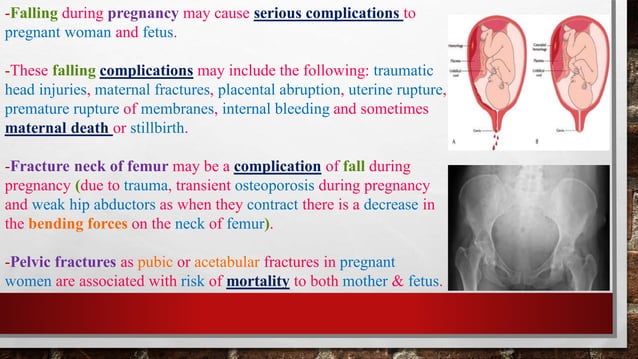 Maternal anatomical, physiological and biomechanical changes during pregnancy | PDF | Pregnancy ...