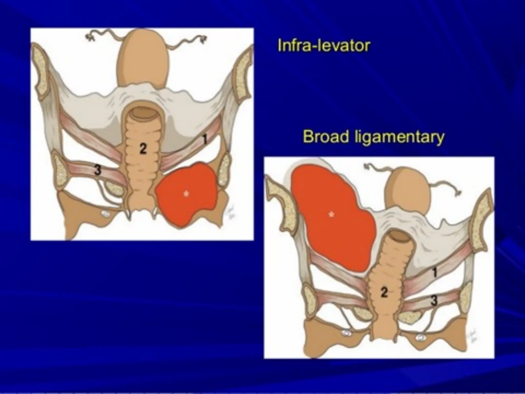 MATERNAL and FETAL INJURIES DURING LABOR.pdf