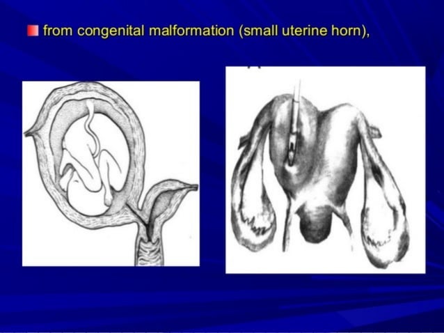 MATERNAL and FETAL INJURIES DURING LABOR.pdf