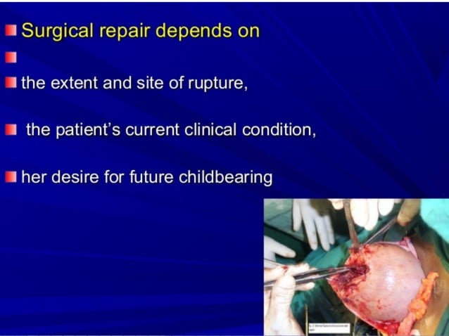 MATERNAL and FETAL INJURIES DURING LABOR.pdf