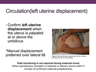 Maternal cardiac arrest (english) | PPTX