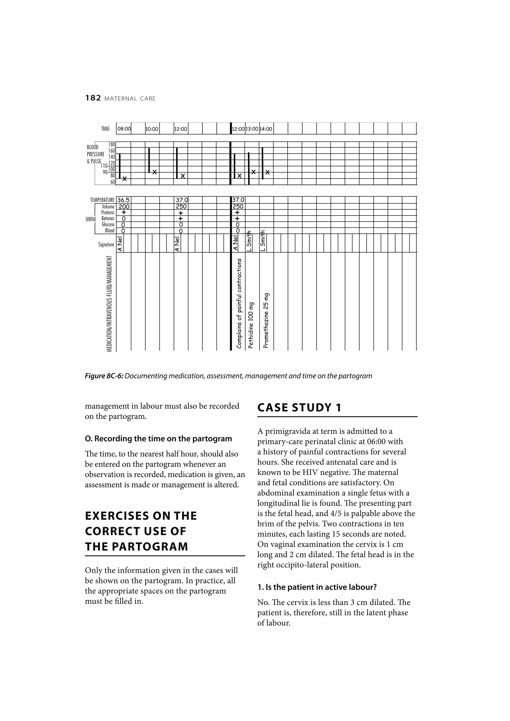 Maternal Care: Skills workshop Recording observation on the partogram | PDF