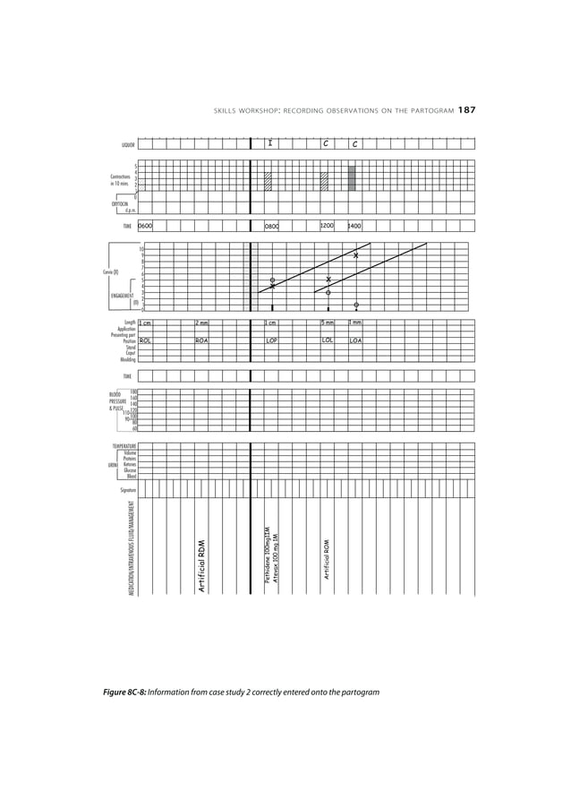Maternal Care: Skills workshop Recording observation on the partogram | PDF