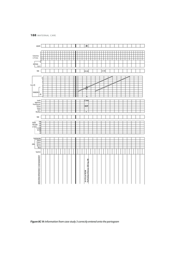 Maternal Care: Skills workshop Recording observation on the partogram | PDF