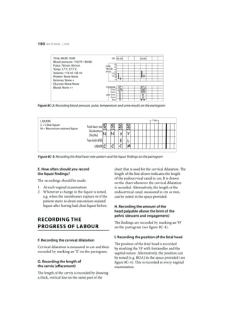 Maternal Care: Skills workshop Recording observation on the partogram | PDF
