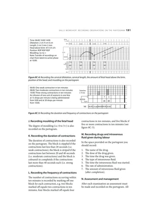 Maternal Care: Skills workshop Recording observation on the partogram | PDF