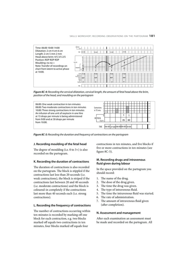 Maternal Care: Skills workshop Recording observation on the partogram | PDF