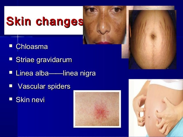 Maternal changes during pregnancy for undergraduate