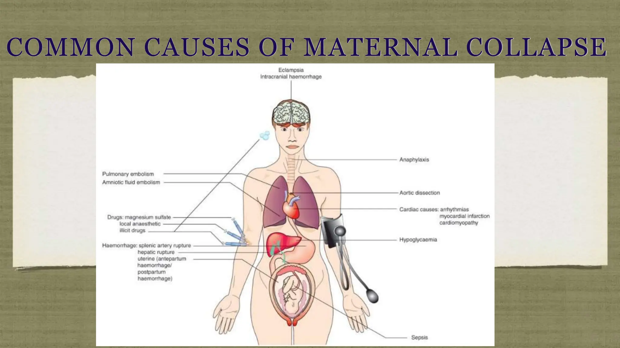 Approach to maternal collapse and cardiac arrest.pptx