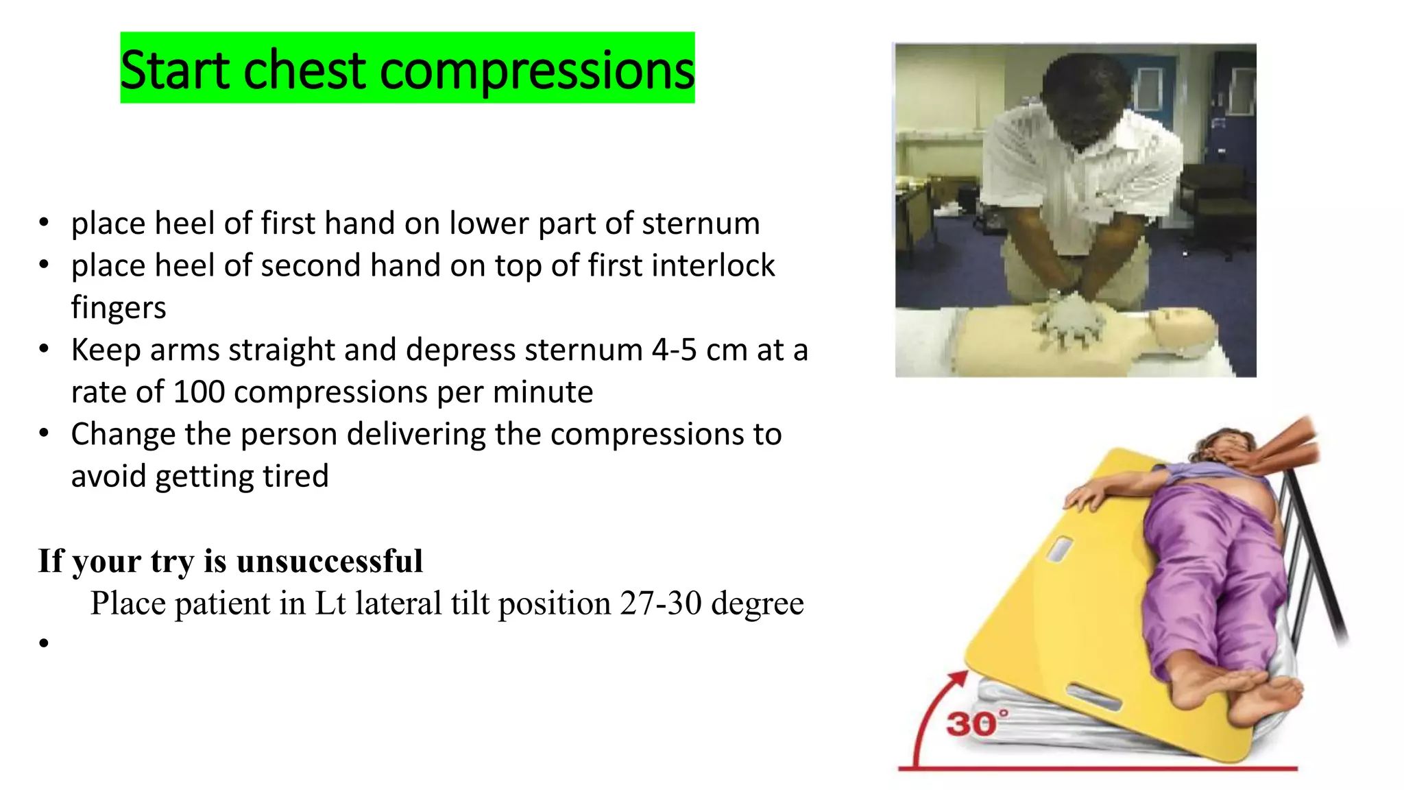Maternal collapse in pregnancy | PPTX