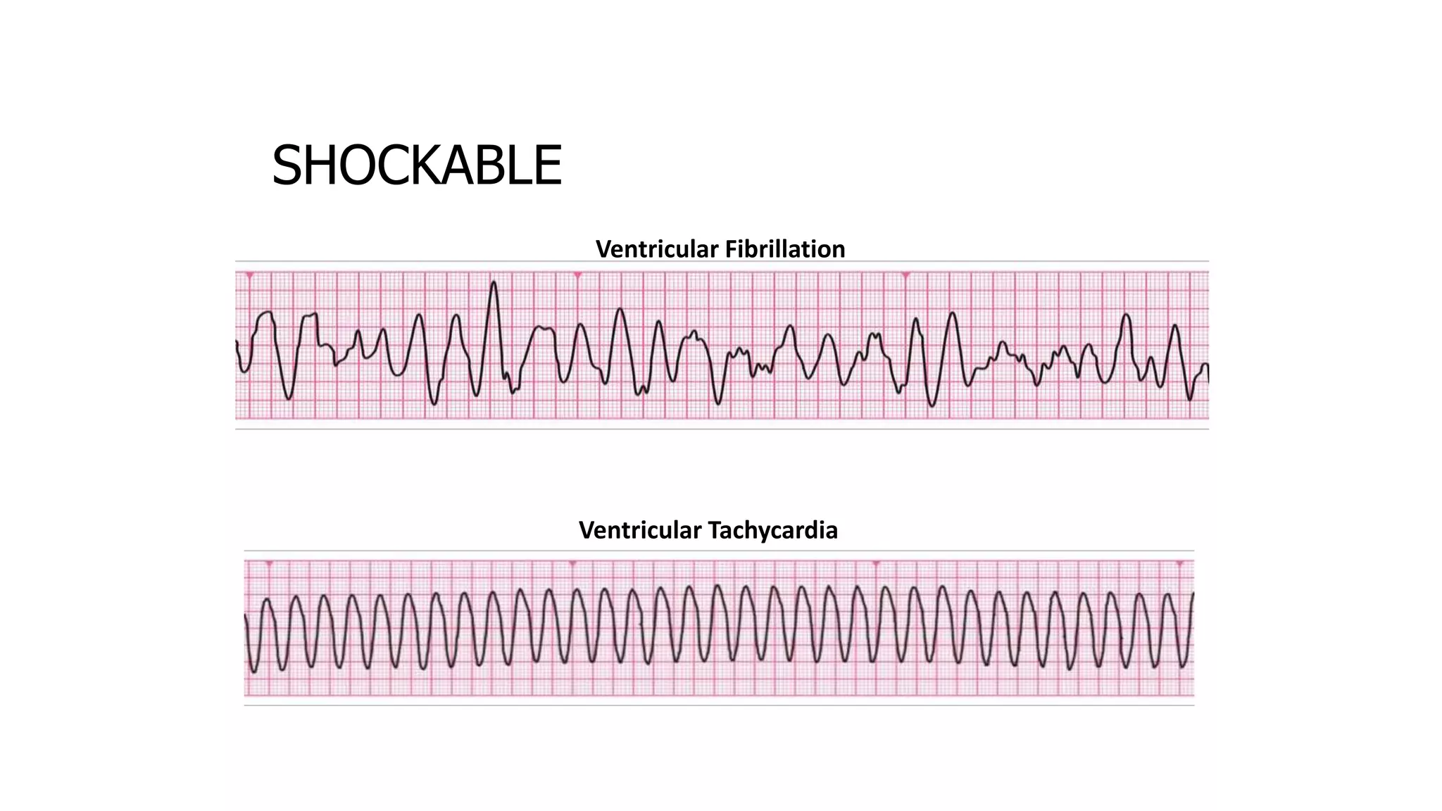 Maternal collapse in pregnancy | PPTX