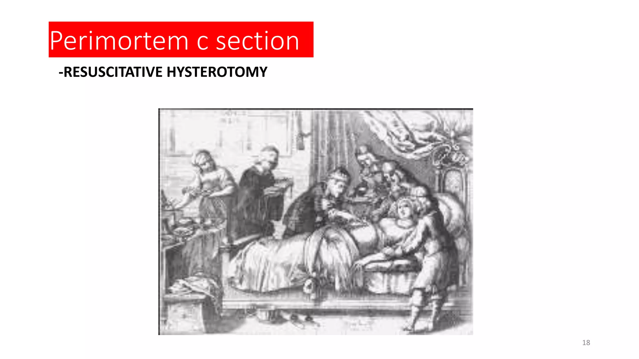 Maternal collapse in pregnancy | PPTX