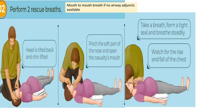 Maternal collapse in pregnancy & puerperium | PPTX