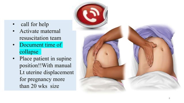 Maternal collapse in pregnancy & puerperium | PPTX