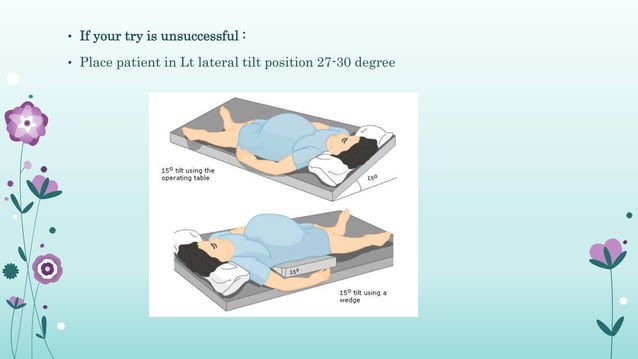 Maternal collapse in pregnancy and purperium.pptx