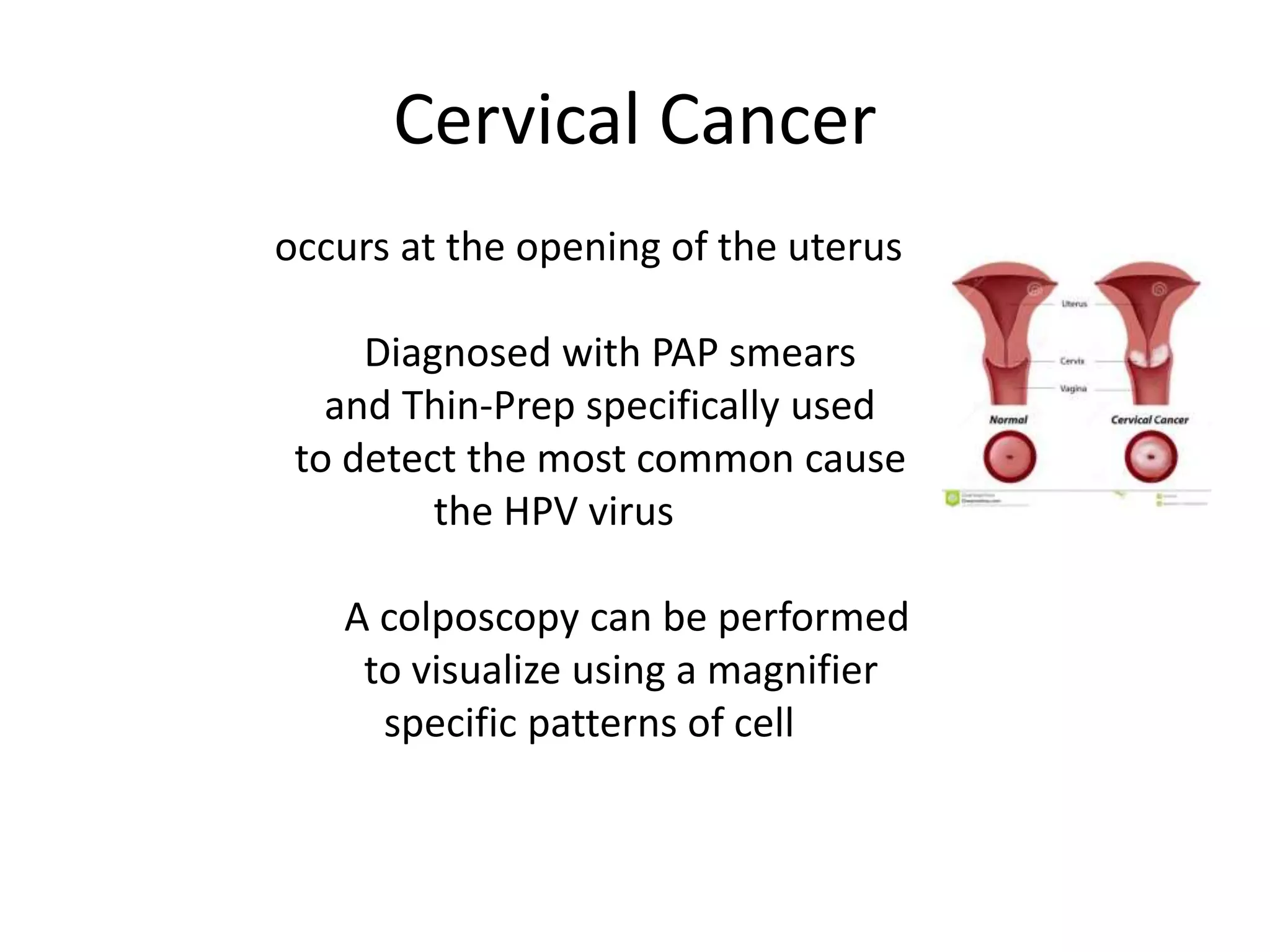 Maternal health cancers of the female reproductive tract | PPTX ...