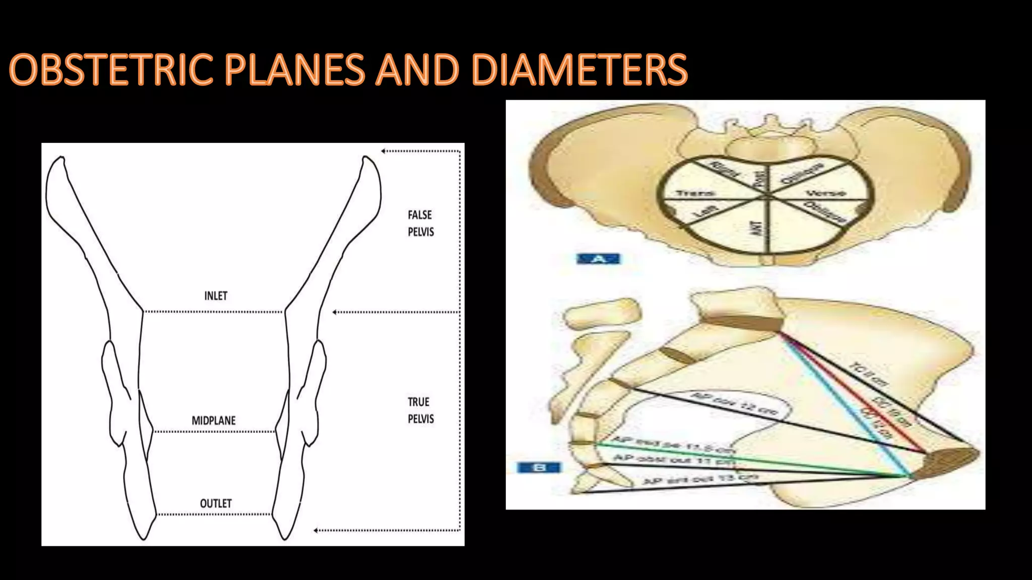 MATERNAL PELVIC DIAMETERS FINAL.pptx