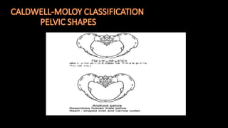 MATERNAL PELVIC DIAMETERS FINAL.pptx