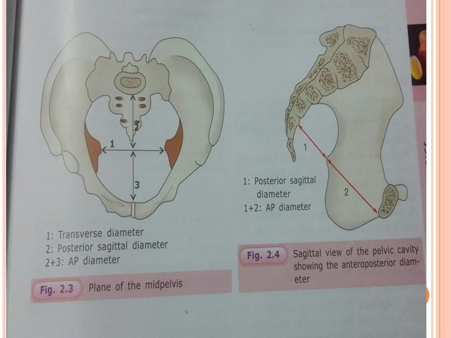 Maternal pelvis | PDF