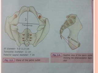 Maternal pelvis | PDF