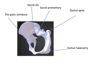 maternal pelvis and it's diameters in obstetrics | PPTX