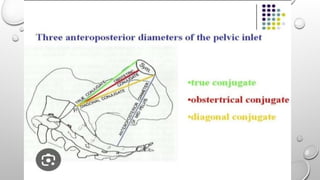 Maternal pelvis..types..delivery assessment | PPTX