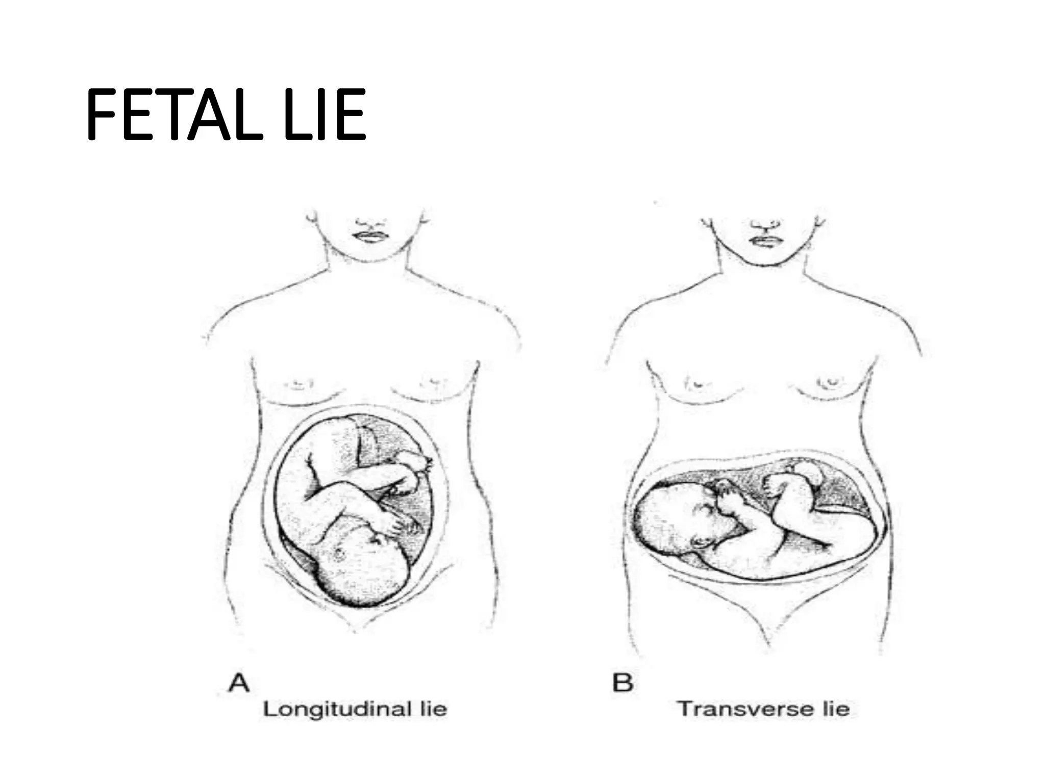 Maternal pelvis and fetal skull | PPTX