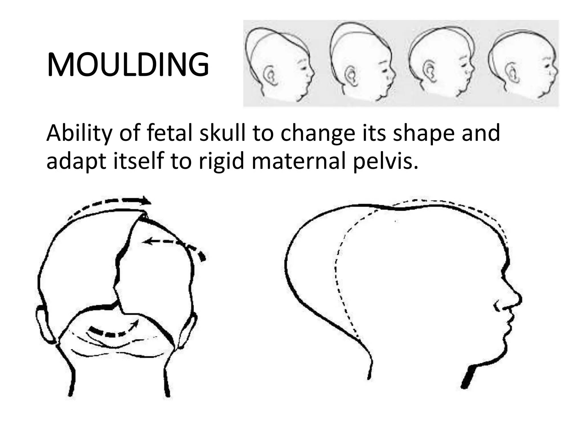 Maternal pelvis and fetal skull | PPTX