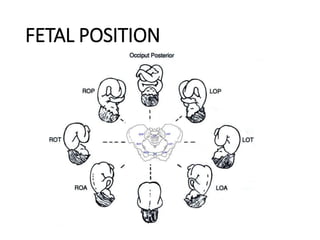 Maternal pelvis and fetal skull | PPTX