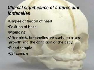 Maternal pelvis and fetal skull | PPTX