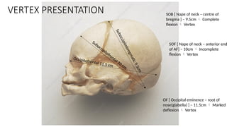 Maternal pelvis & Fetal skull obsterics.pptx