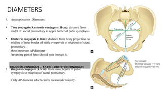 Maternal pelvis & Fetal skull obsterics.pptx
