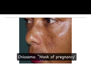 Maternal physiology | PPTX