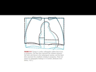 Maternal physiology | PPTX
