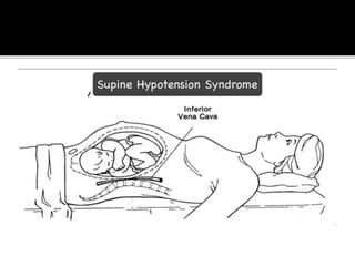 Maternal physiology | PPTX