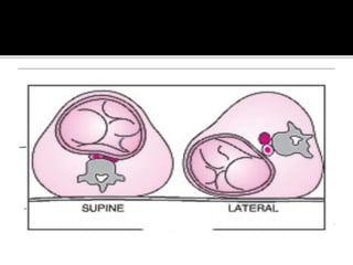 Maternal physiology | PPT