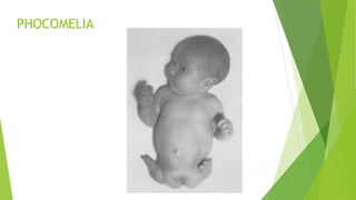 Maternal prenatal and genetic influence on defects and diseases (Unit ...
