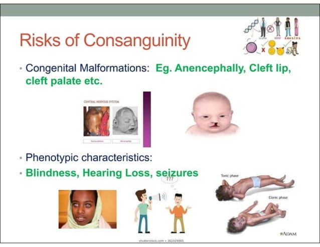 Maternal prenatal and genetic influences on development of defect and ...