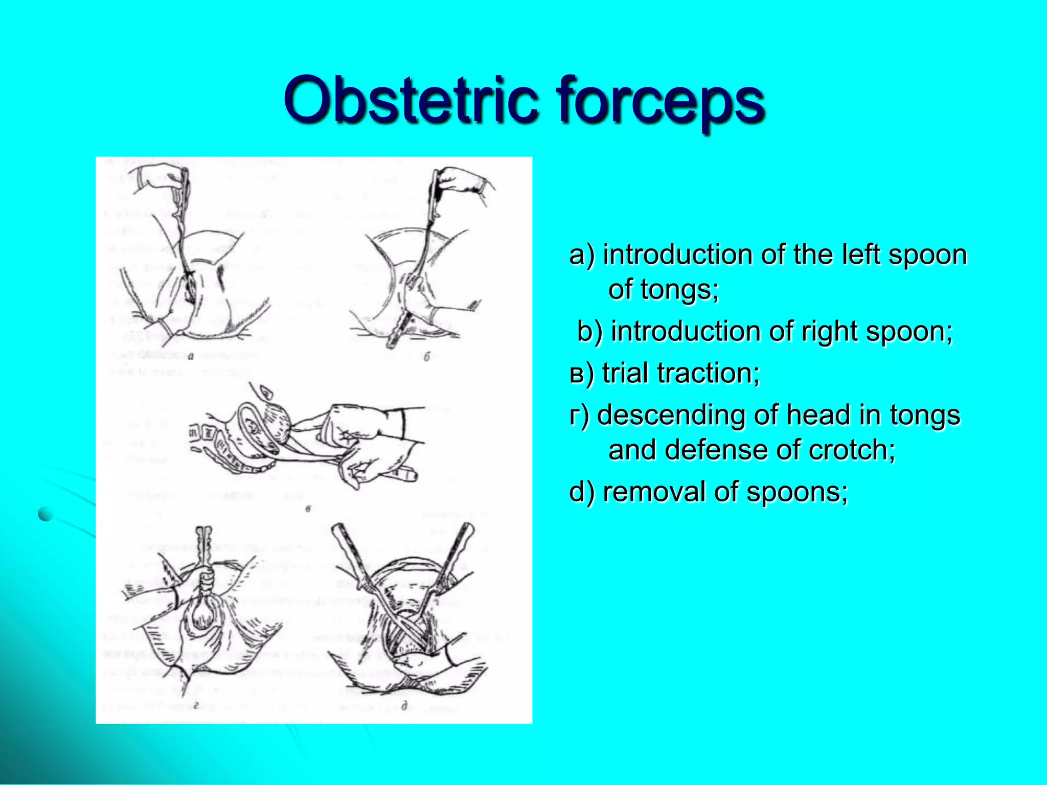 Maternal trauma. obstetric surgeries | PPTX