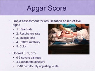 Newborn Health Assessment | PPT