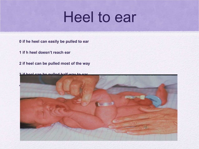 Newborn Health Assessment | PPT